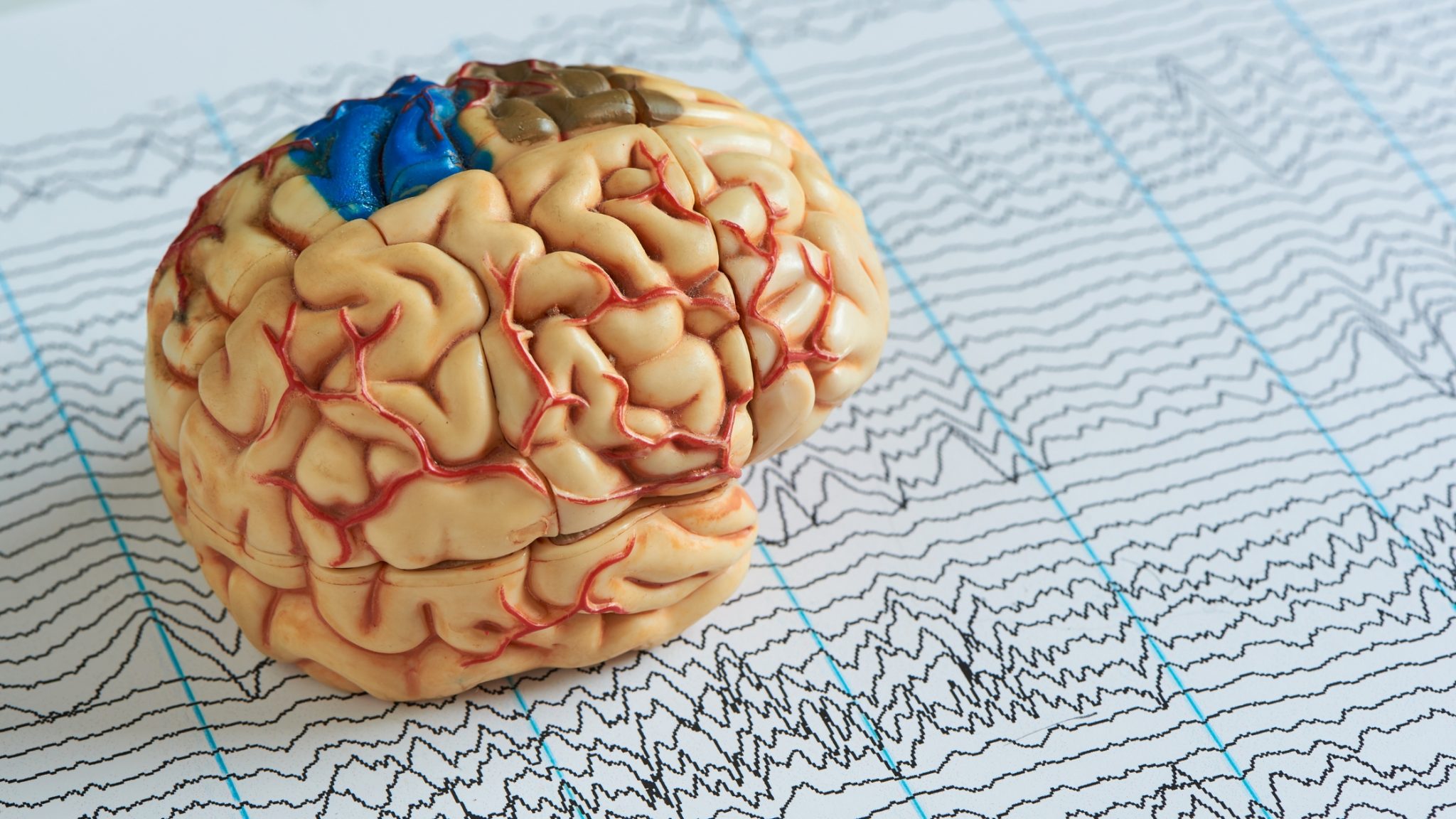 Is Epilepsy a Disability? TPD Claim Help Guide